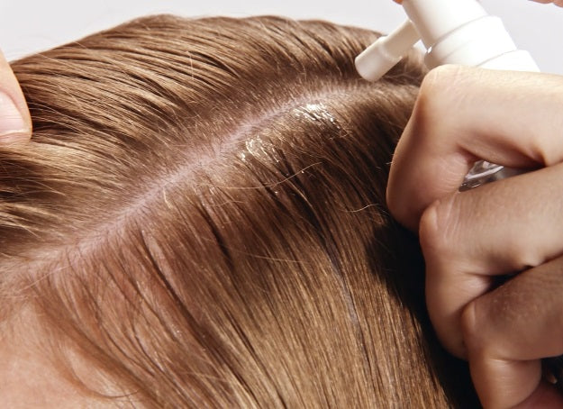 Nioxin Treatments – Peter Mark